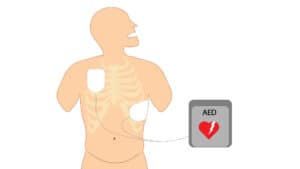 AED vs CPR Survival Rates: Which Saves More Lives?